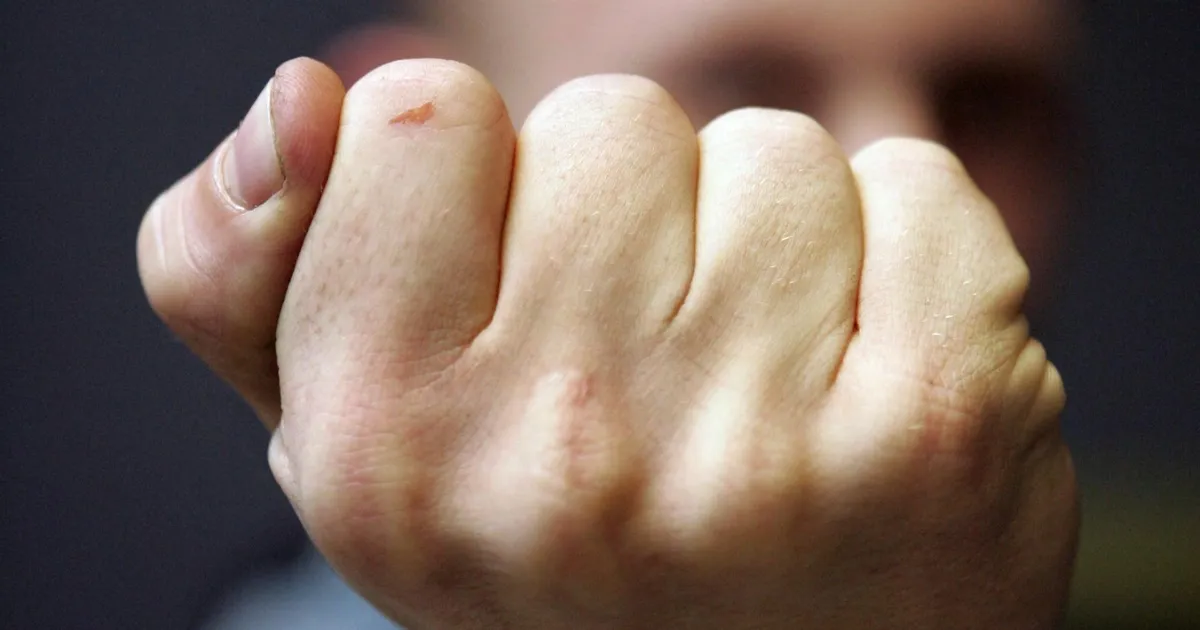 Prillikandja peksmine jättis ohvrile näkku haava