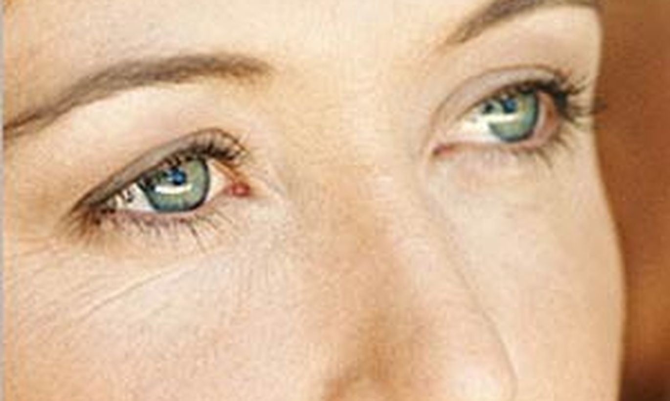 Acis sarkanas kā trusītim - Veselība - Ziņas - Apollo.lv