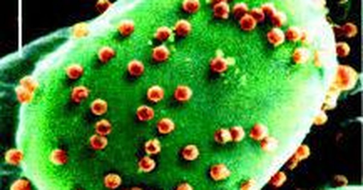 Teadlased avastasid inimlikku rumalust põhjustava viiruse - Kirev elu ...